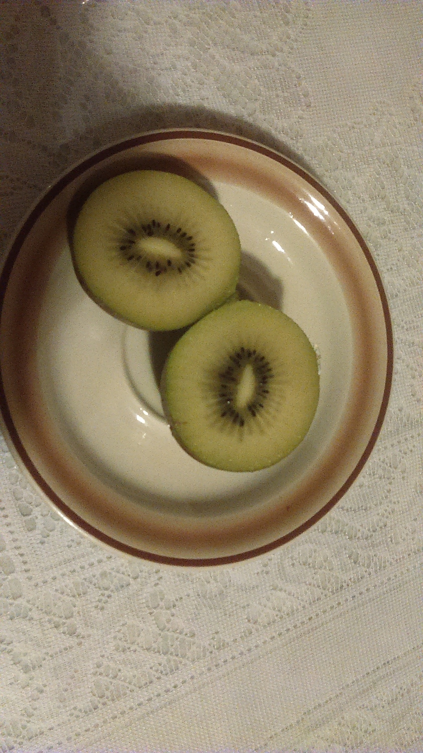 The World Finest Yellow Kiwi From New Zealand General Fruit Growing Growing Fruit